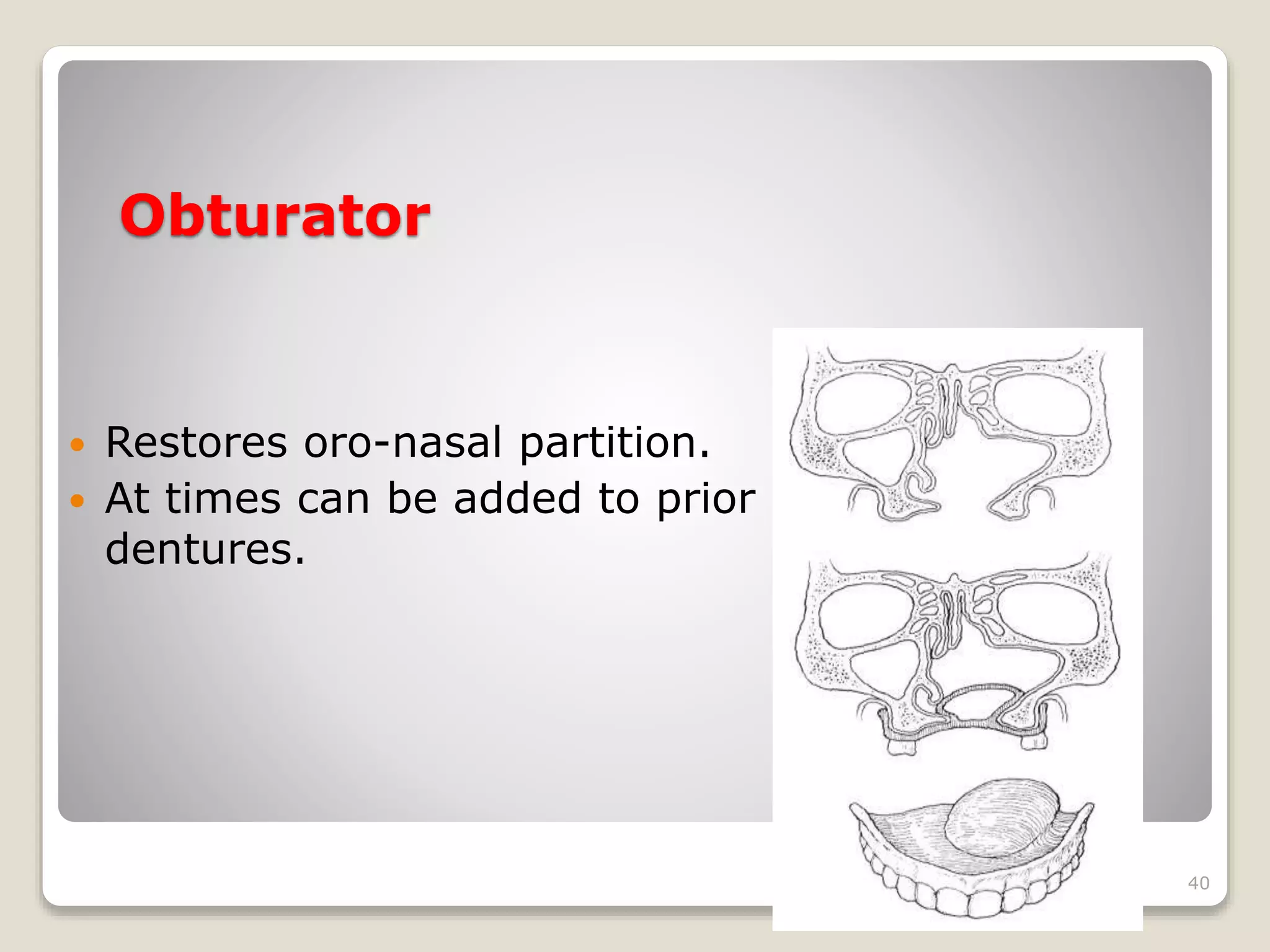 Maxillofacial prosthesis | PPTX