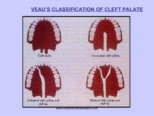 Maxillofacial /orthodontic courses by Indian dental academy