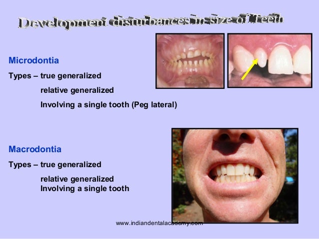 Maxillofacial /orthodontic courses by Indian dental academy