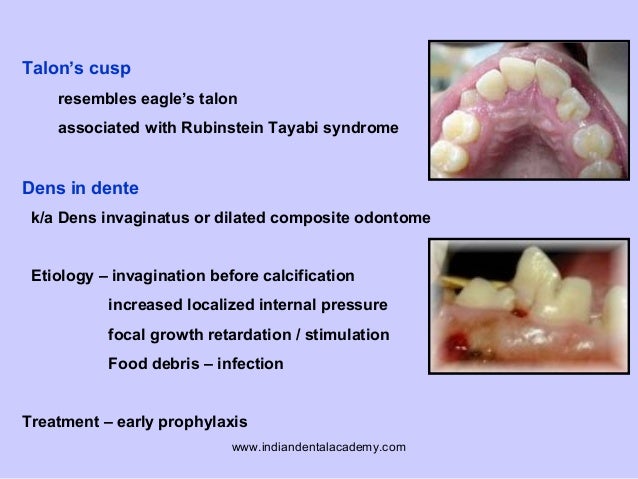 Maxillofacial /orthodontic courses by Indian dental academy