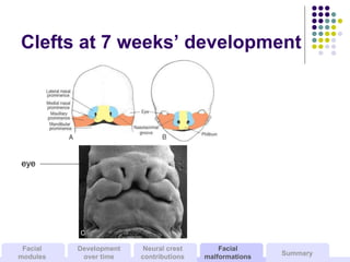 Maxillofacial Embryology And Development | PPT