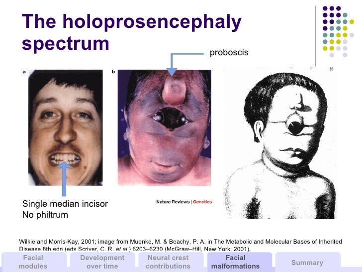 Maxillofacial Embryology And Development