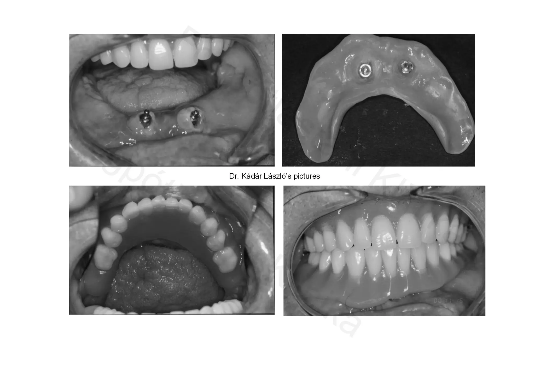 Maxillofacial-prosthetics.pdf