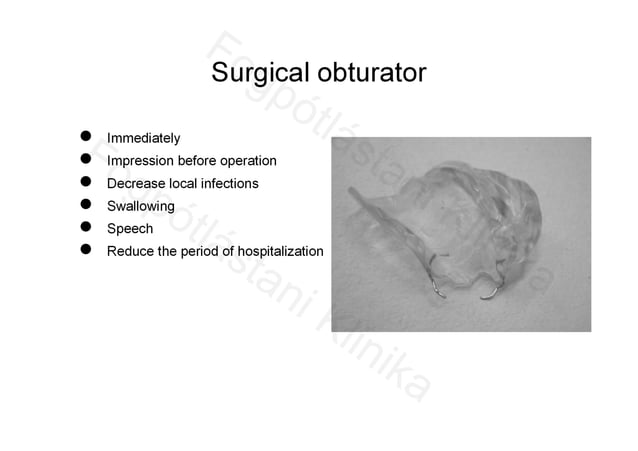 Maxillofacial-prosthetics.pdf