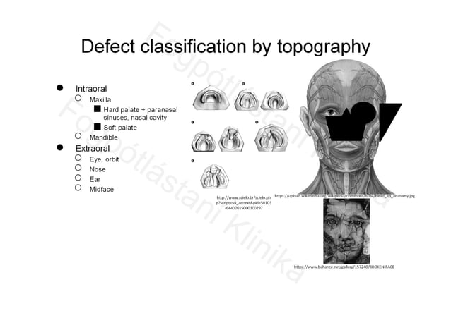 Maxillofacial-prosthetics.pdf