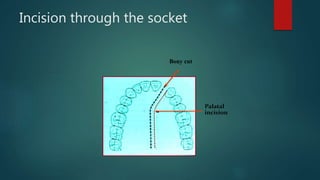 MAXILLOFACIAL 2.pptx | Dental Health | Diseases and Conditions