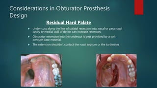 MAXILLOFACIAL 2.pptx