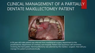 MAXILLOFACIAL 2.pptx