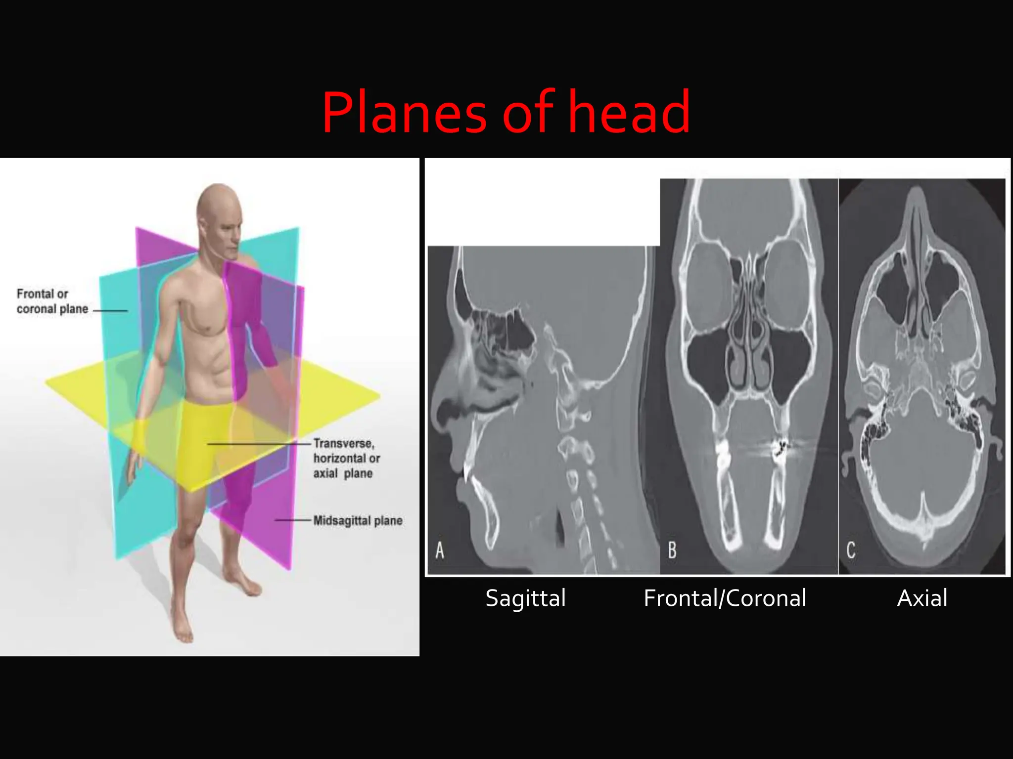 Maxillofacial imaging in implant treatment planning.pptx