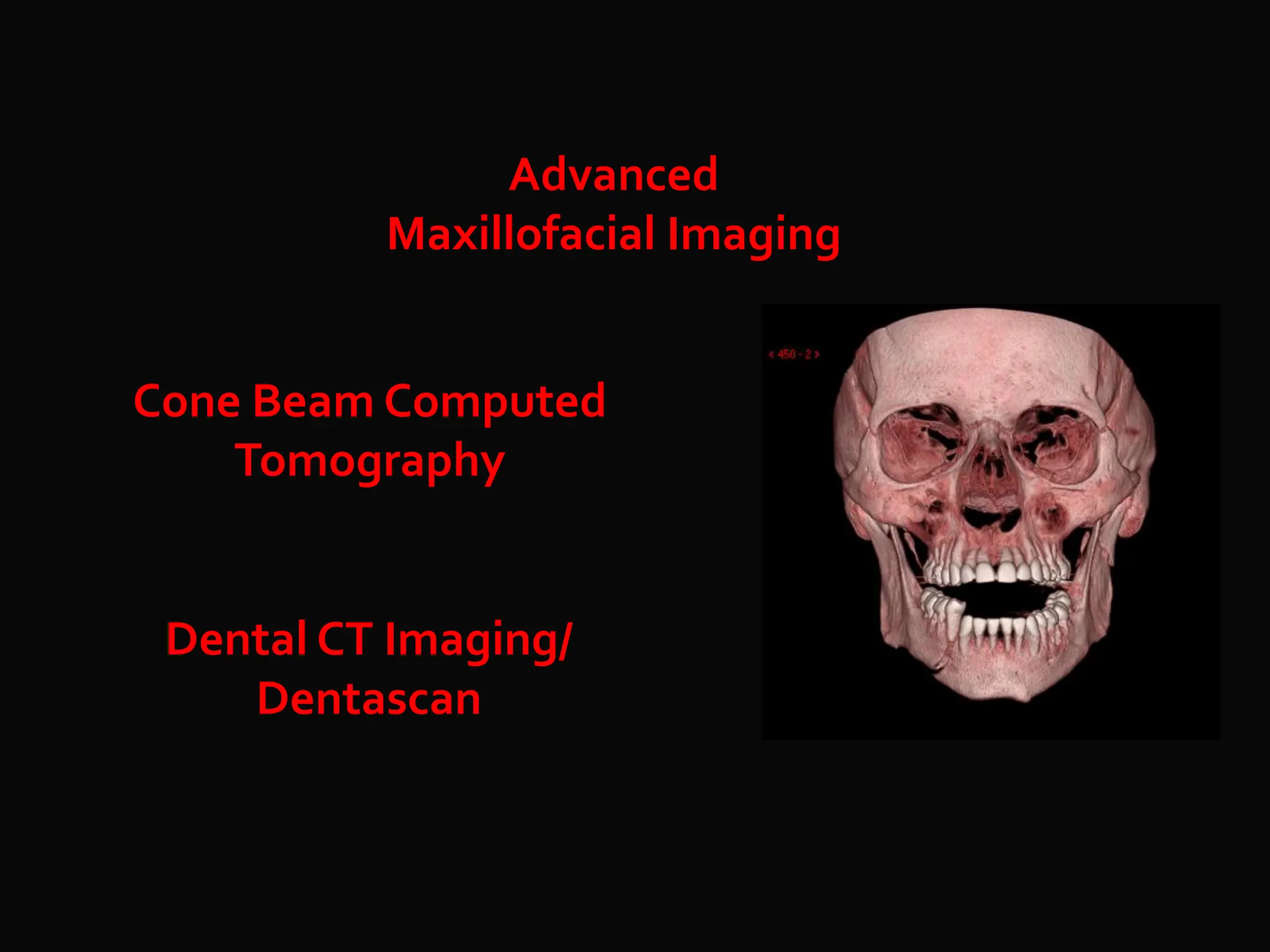 Maxillofacial imaging in implant treatment planning.pptx