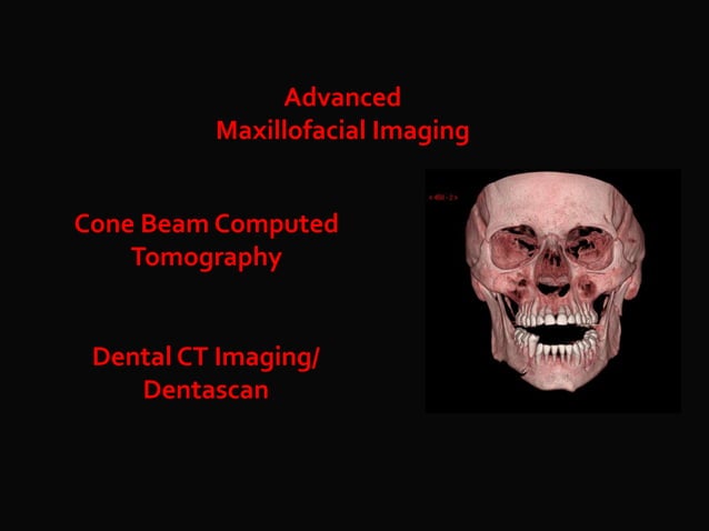 Maxillofacial imaging in implant treatment planning.pptx