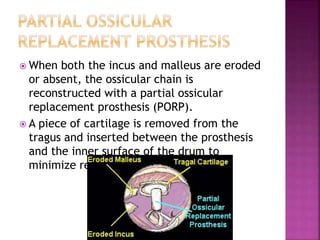 Maxillofacial implants and ear implants | PPT