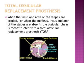 Maxillofacial implants and ear implants | PPT