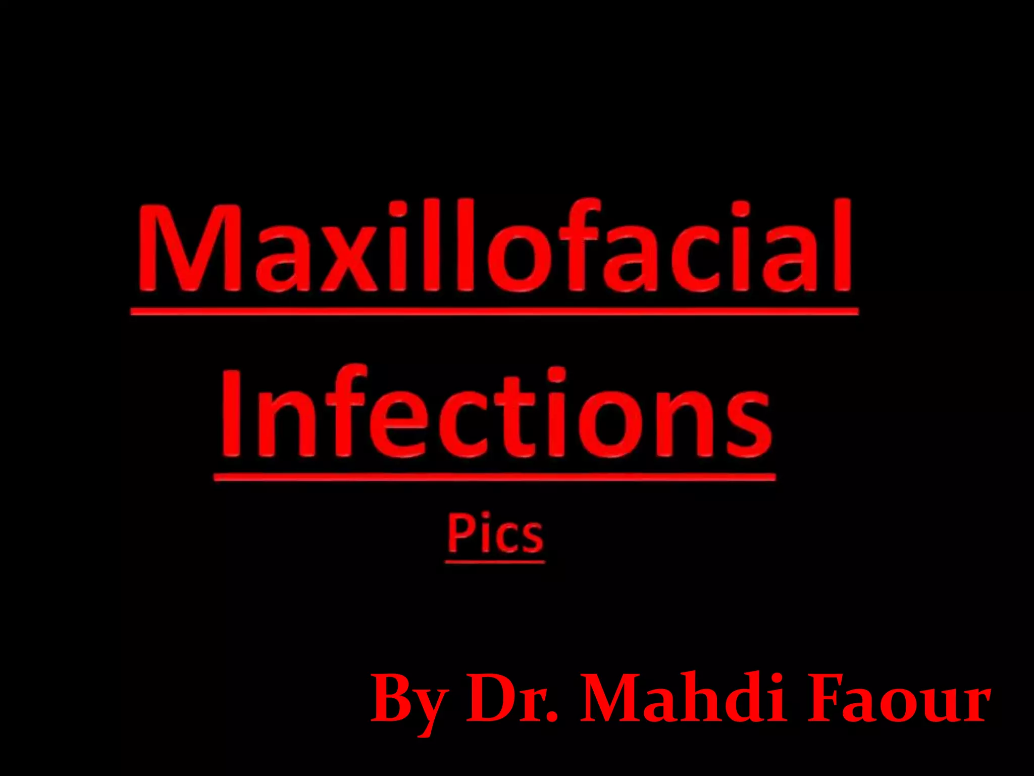 Maxillofacial infections | PPSX