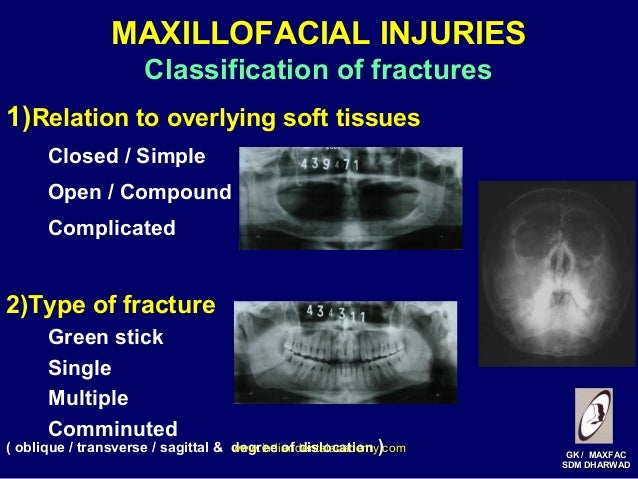 Maxillofacial injuries (2)