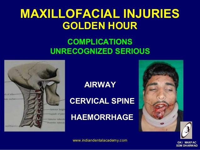 Maxillofacial injuries (2)