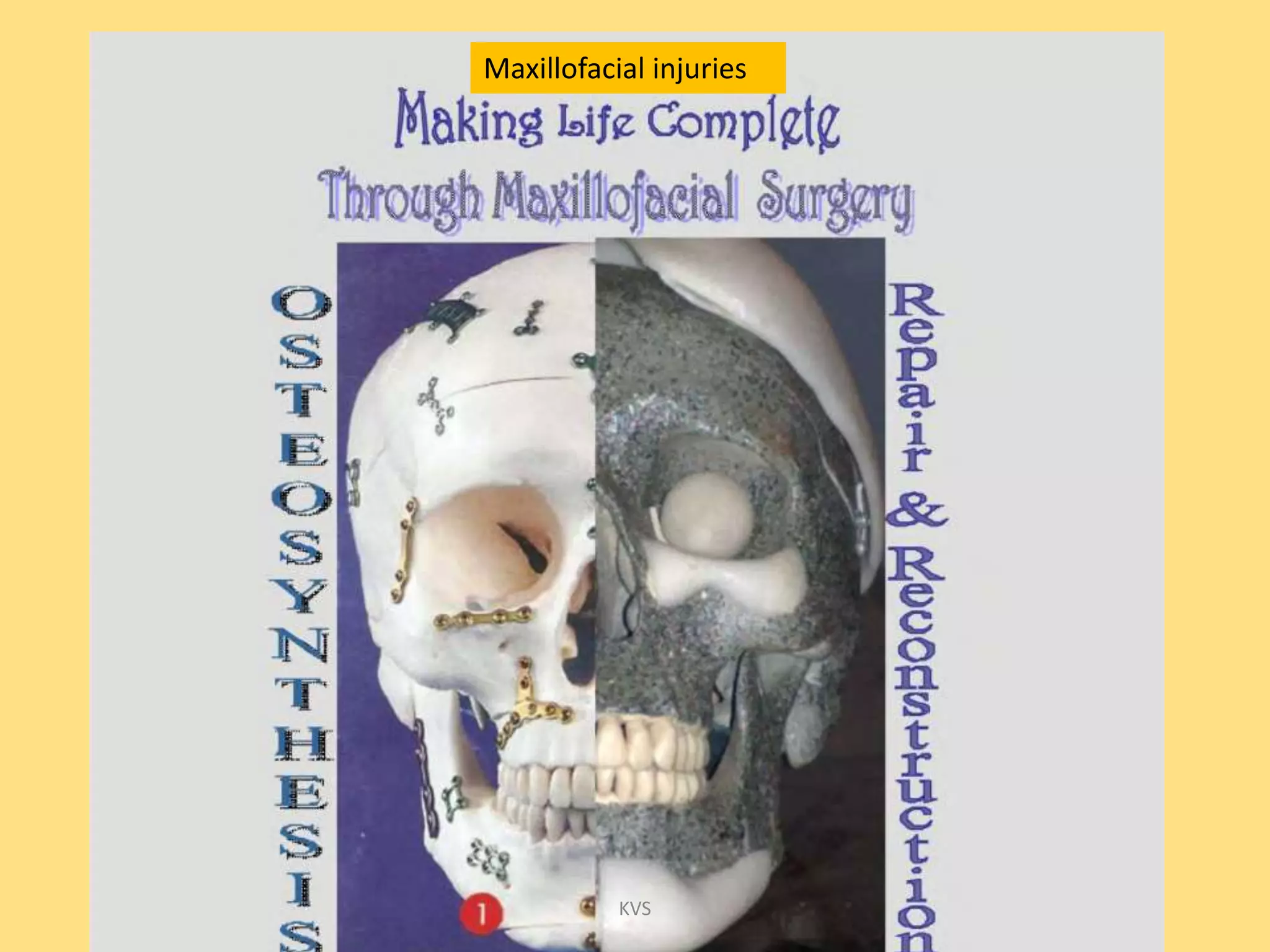 Maxillofacial injuries | PPTX