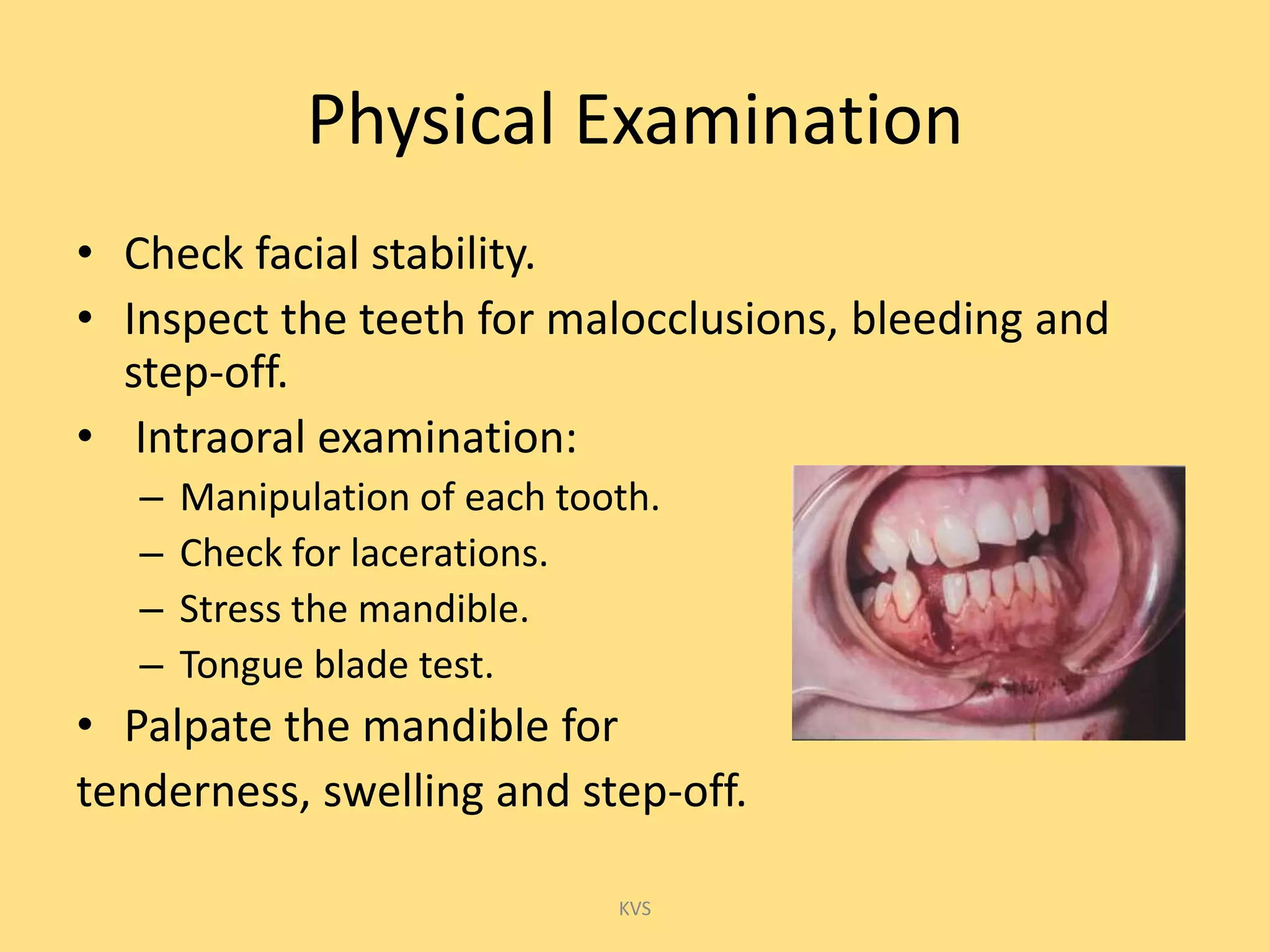 Maxillofacial injuries | PPTX