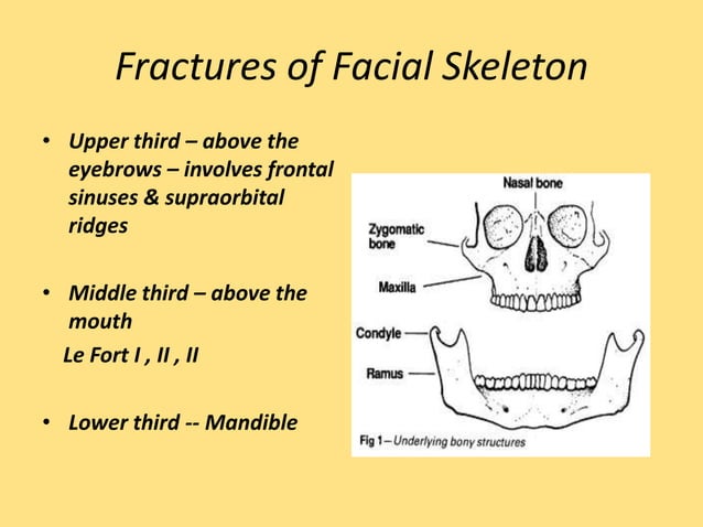 Maxillofacial injuries | PPTX