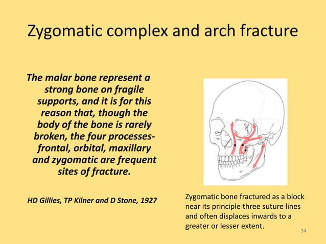 Maxillofacial injuries | PPTX