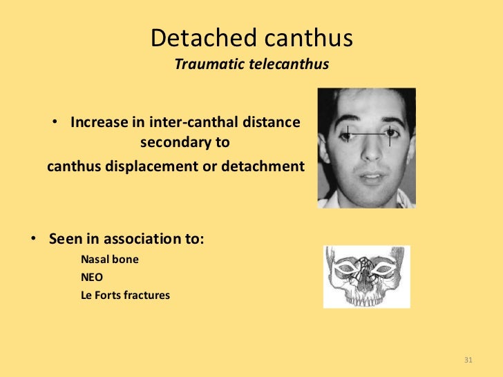 Maxillofacial injuries