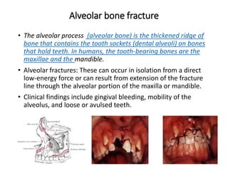 Maxillofacial injury | PPT