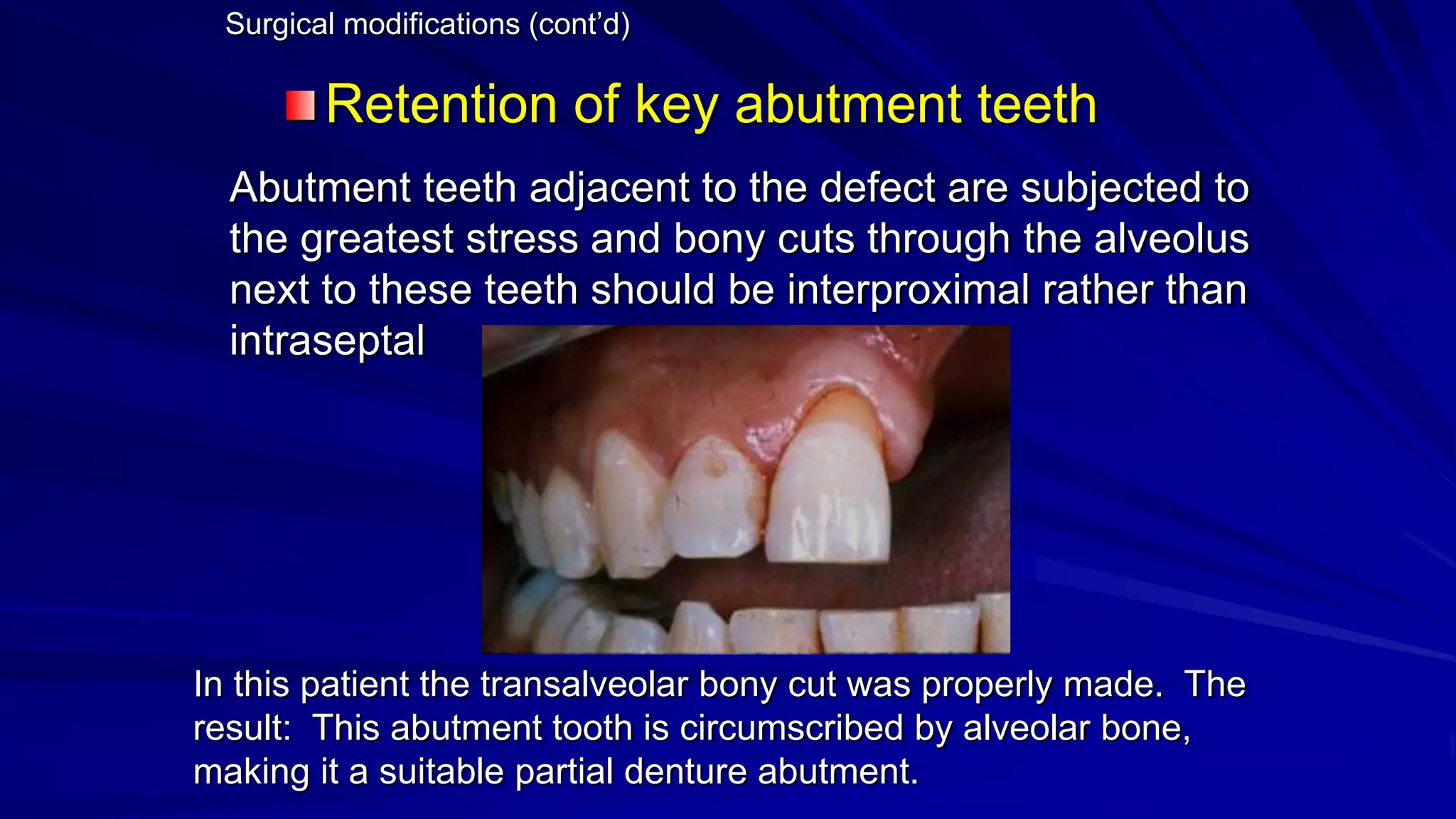 maxillofacial prosth..pptx | Dental Health | Diseases and Conditions