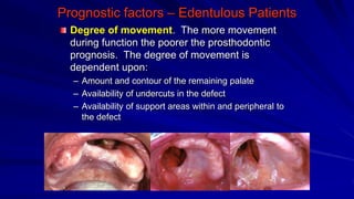 maxillofacial prosth..pptx