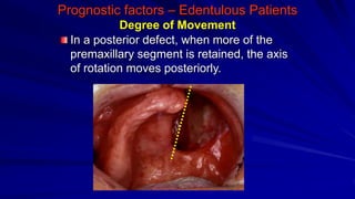 maxillofacial prosth..pptx