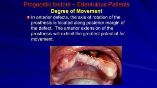 maxillofacial prosth..pptx