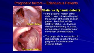 maxillofacial prosth..pptx
