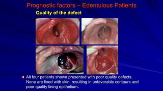 maxillofacial prosth..pptx