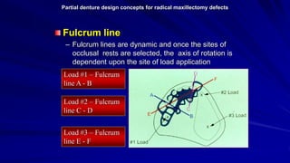 maxillofacial prosth..pptx