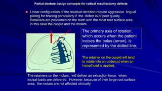 maxillofacial prosth..pptx