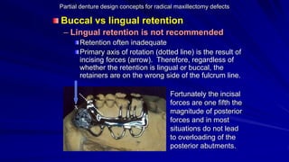 maxillofacial prosth..pptx