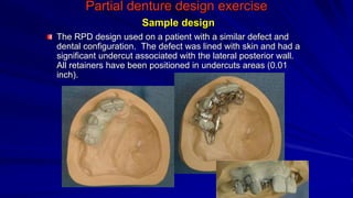 maxillofacial prosth..pptx
