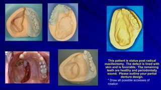 maxillofacial prosth..pptx