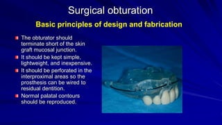 maxillofacial prosth..pptx