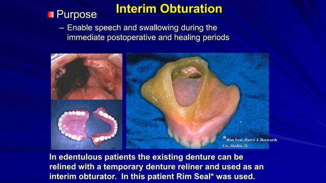 maxillofacial prosth..pptx | Dental Health | Diseases and Conditions
