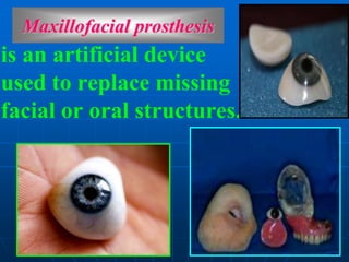 Maxillofacial prosthesis | PPTX