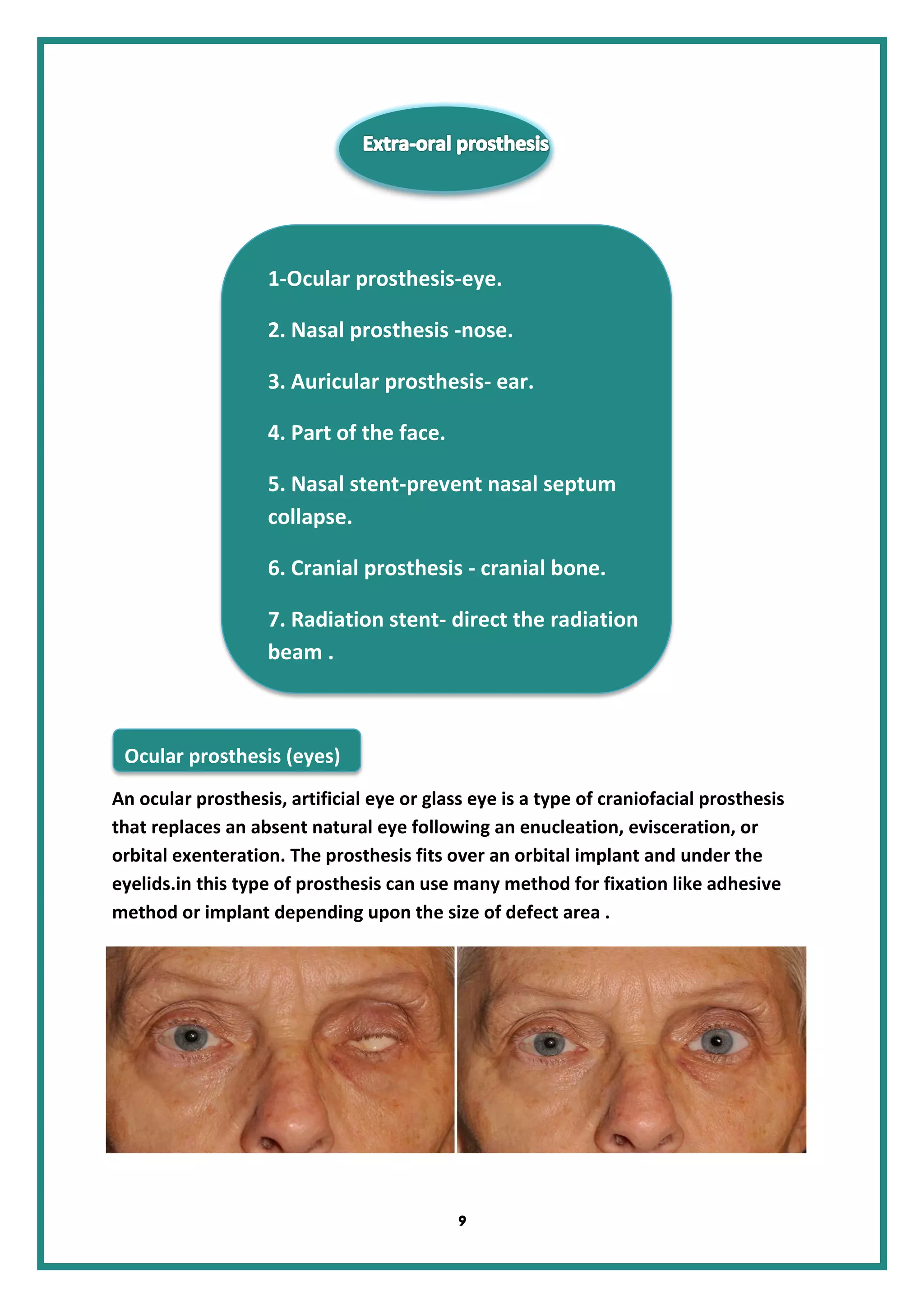 Maxillofacial Prosthesis | PDF