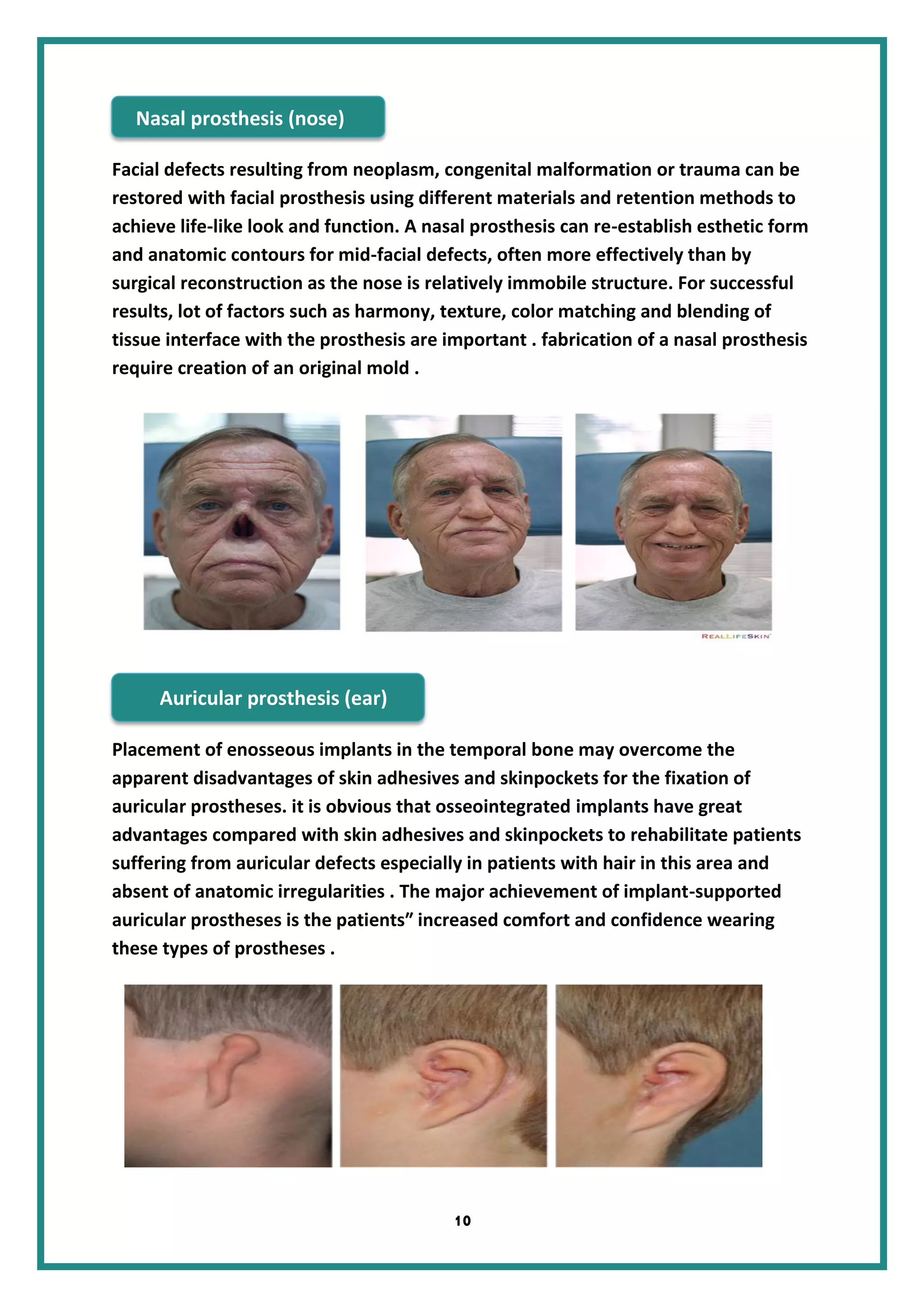Maxillofacial Prosthesis | PDF
