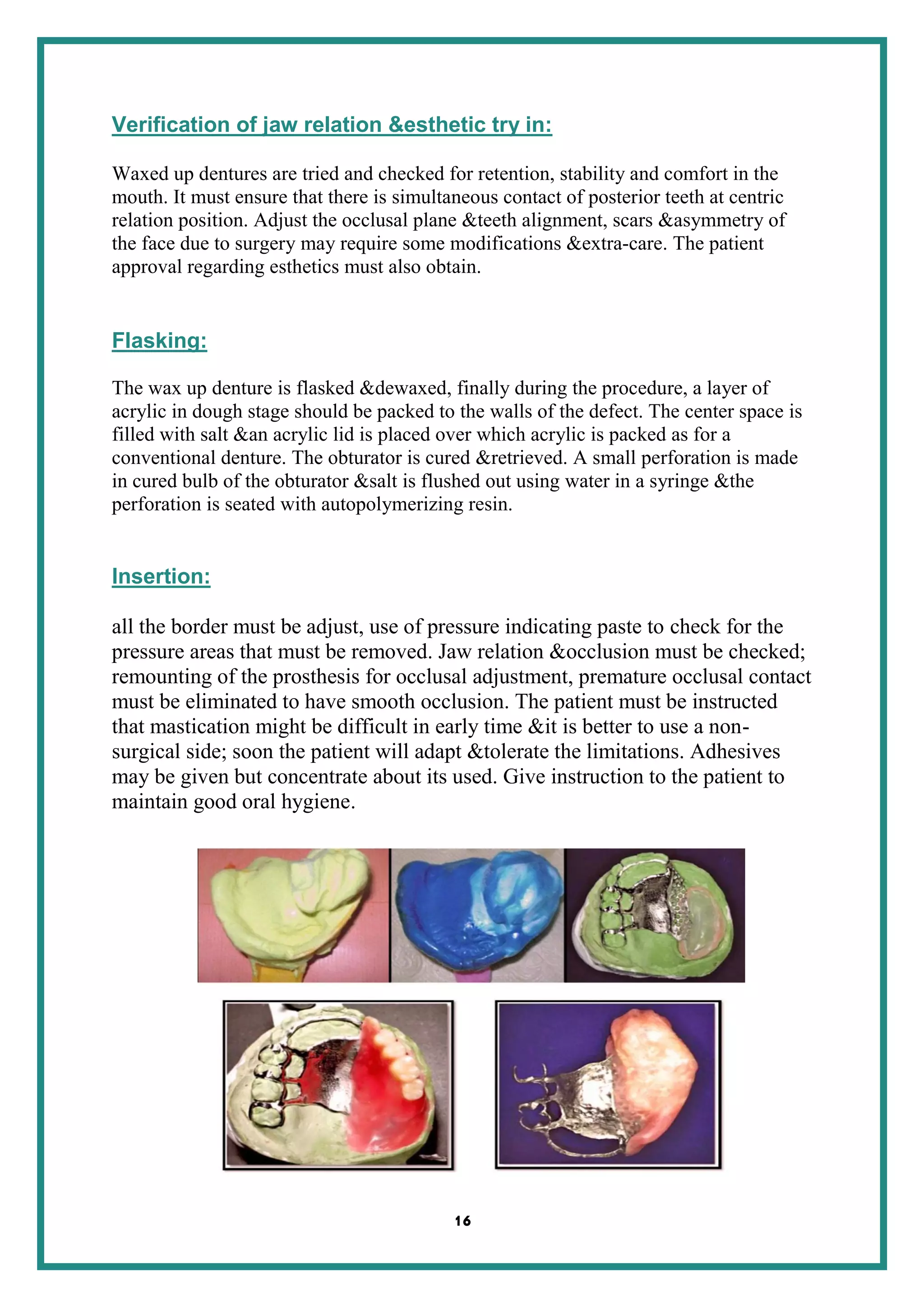 Maxillofacial Prosthesis | PDF