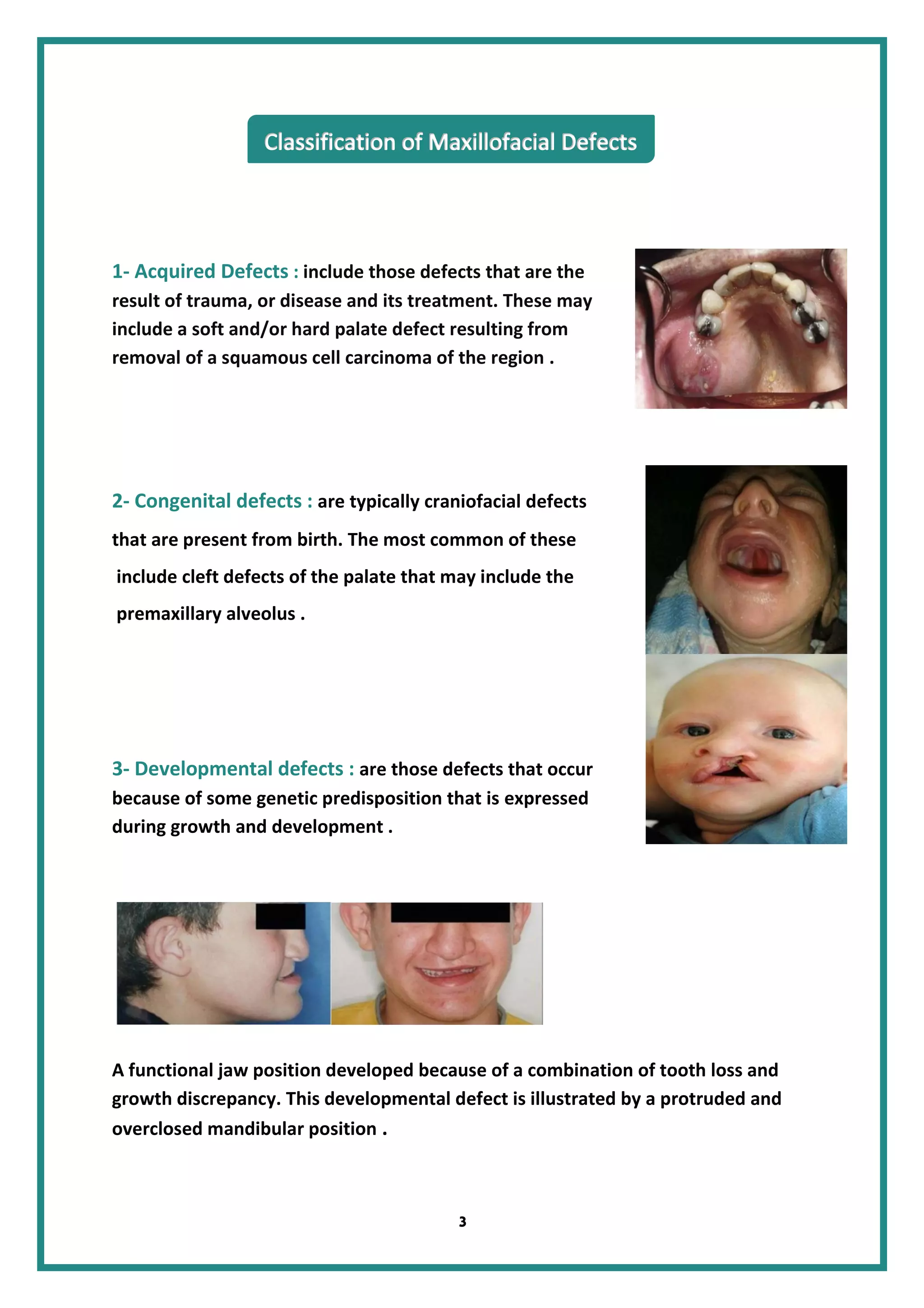 Maxillofacial Prosthesis | PDF
