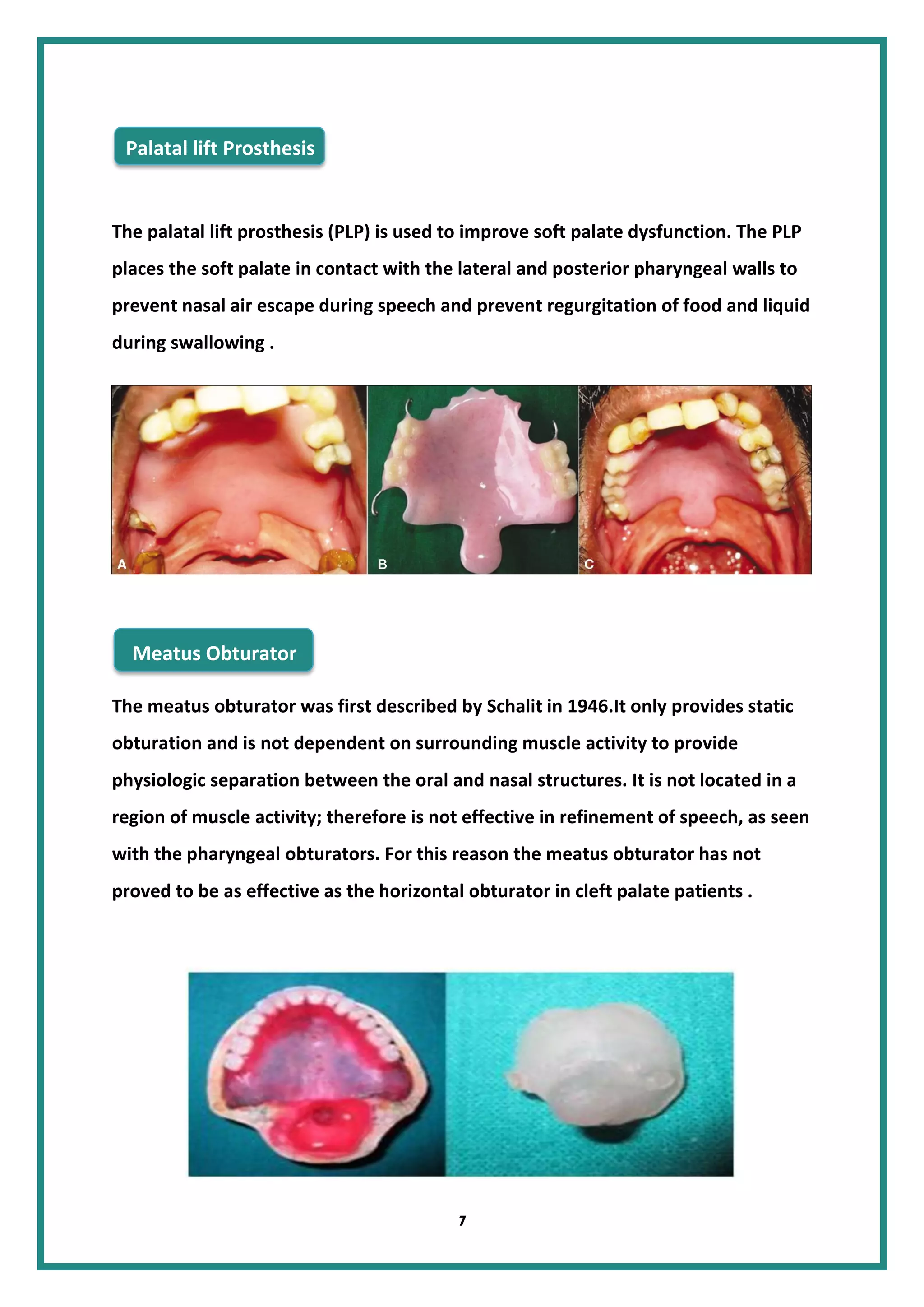Maxillofacial Prosthesis | PDF