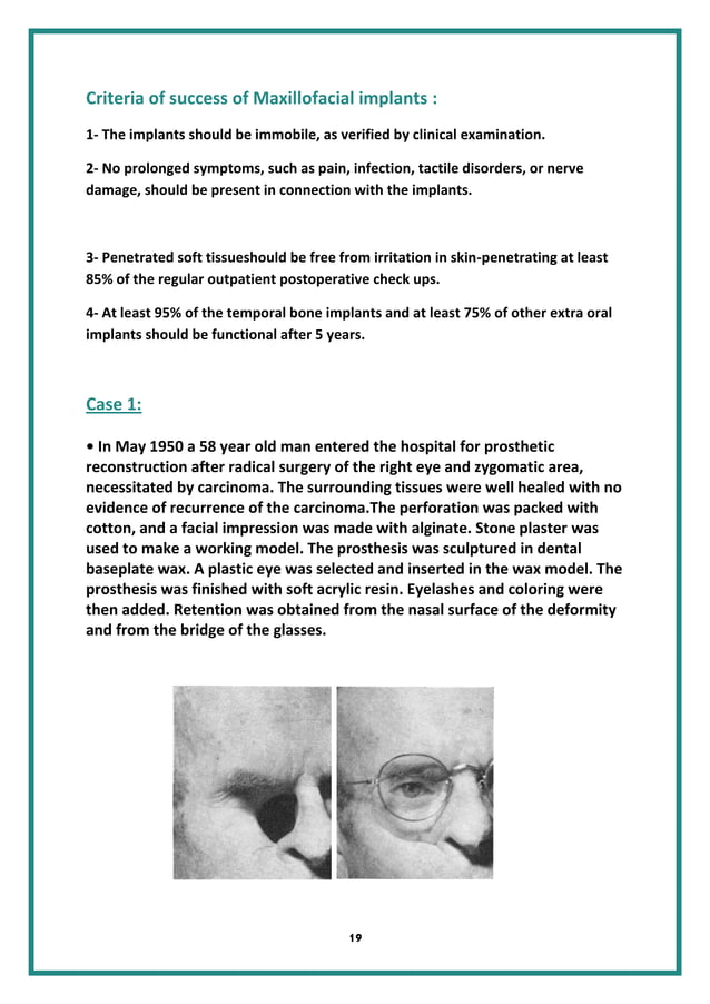 Maxillofacial Prosthesis | PDF