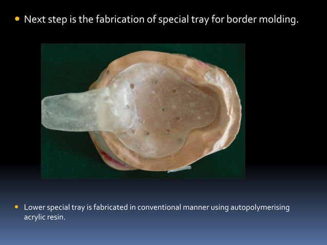 Maxillofacial prosthesis of soft cleft palate | PPTX