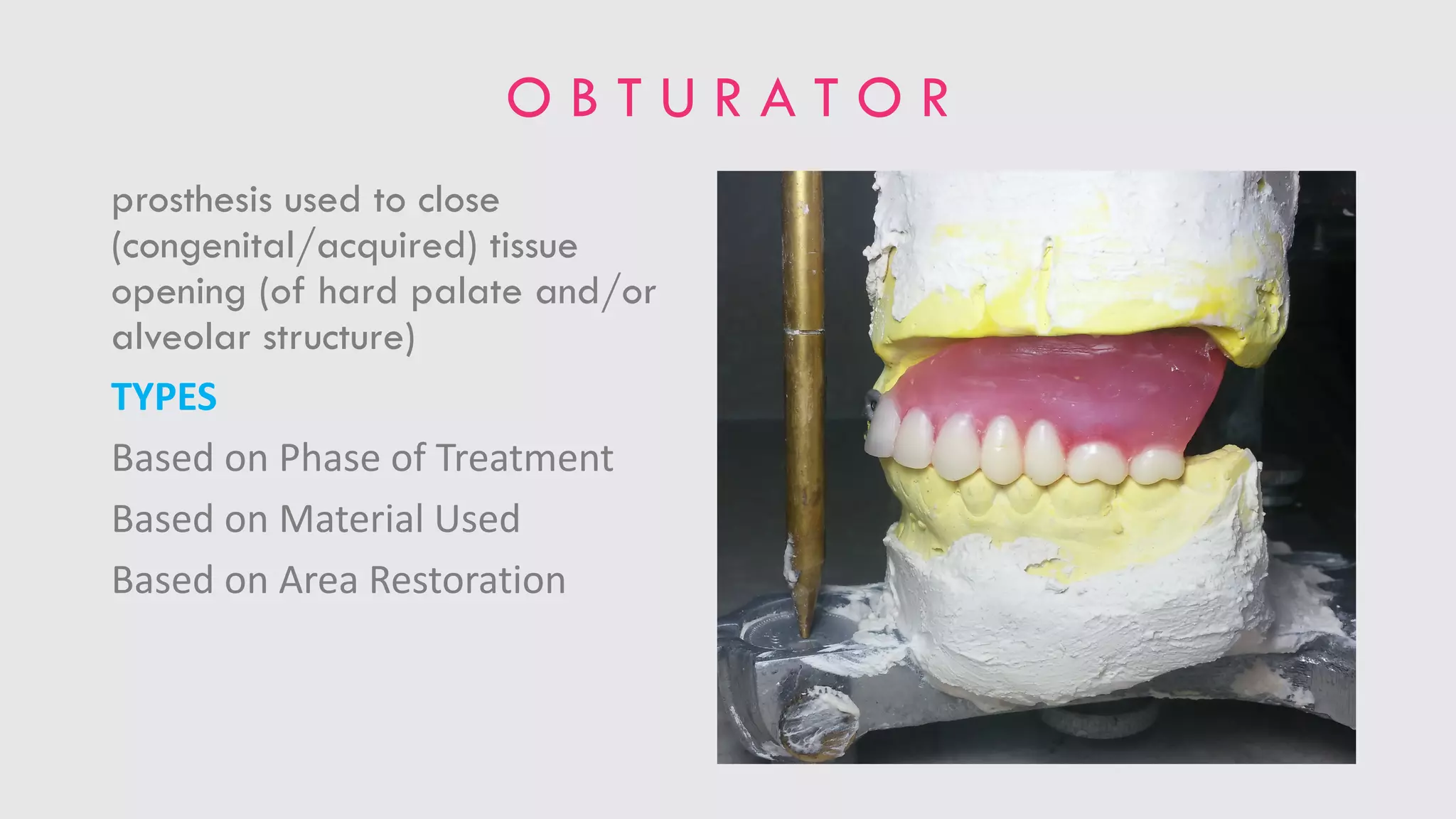 Maxillofacial Prosthetics | Intro & Basics, Obturator, Splint, Intra ...