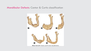 Maxillofacial Prosthetics | Intro & Basics, Obturator, Splint, Intra ...