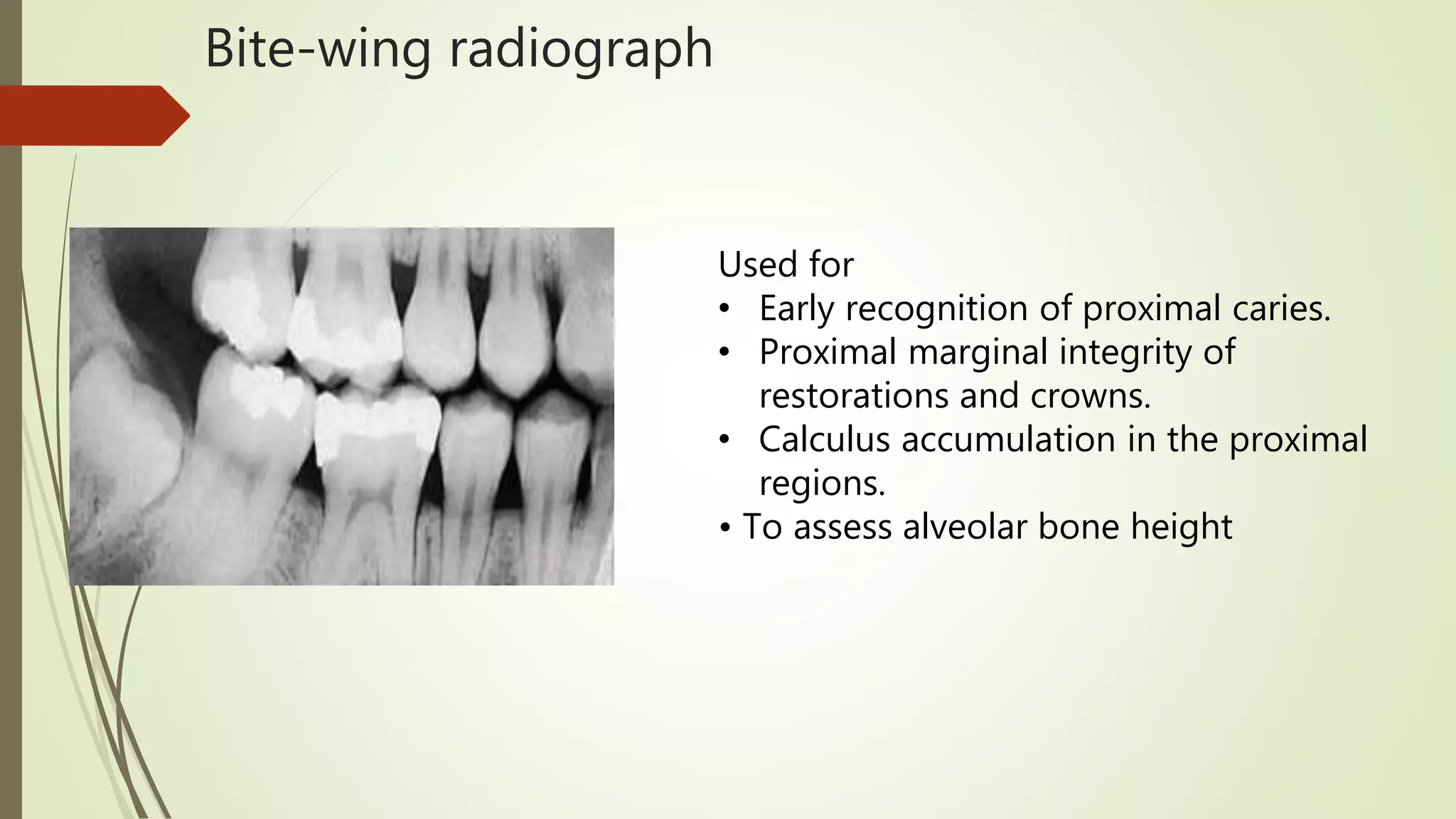 Maxillofacial radiology | PPTX